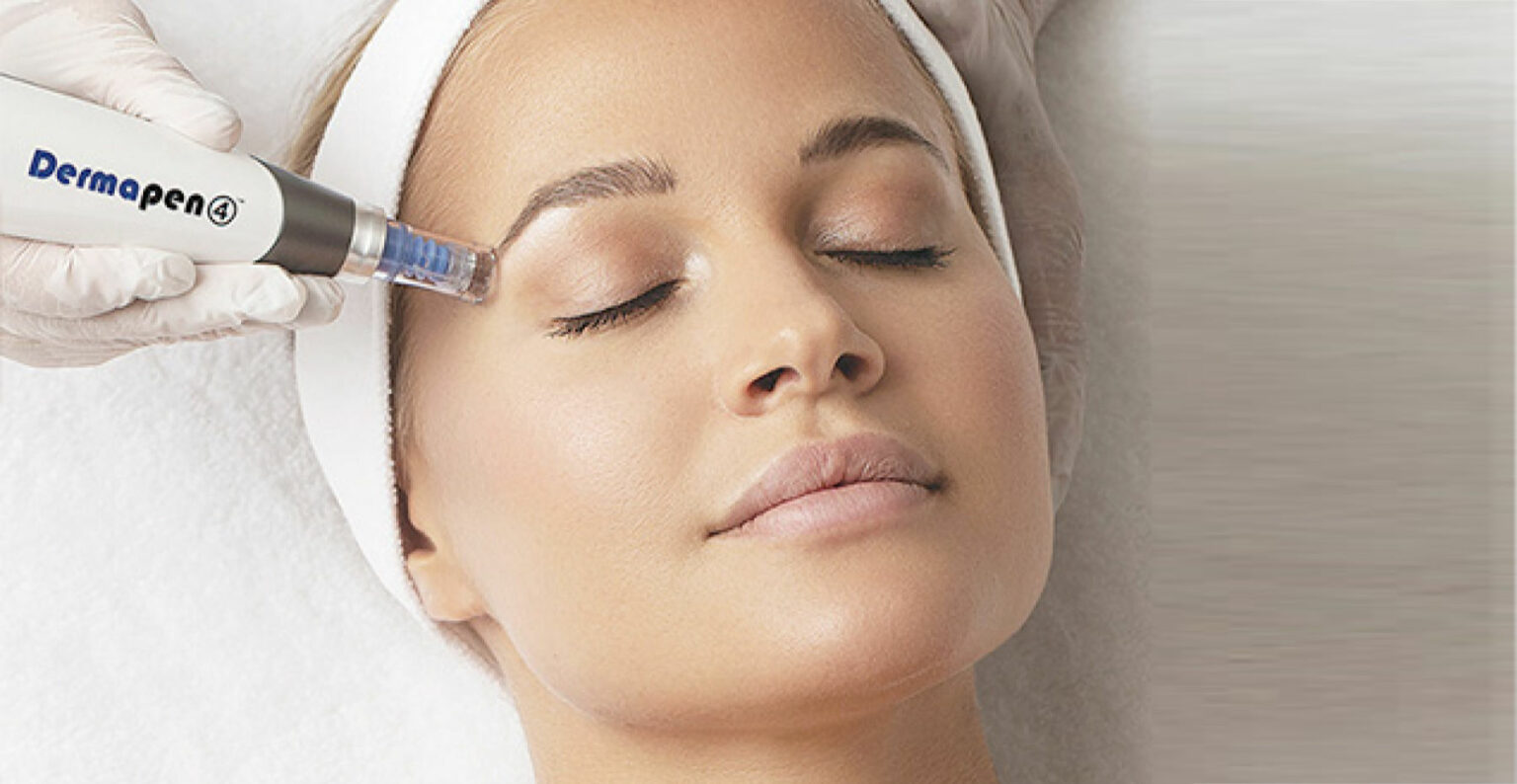 Microneedling au Dermapen - Clinique NOVA Fréjus